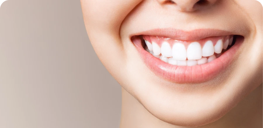 Comprendre et traiter les dents jaunes | Dentistes Lyon 8